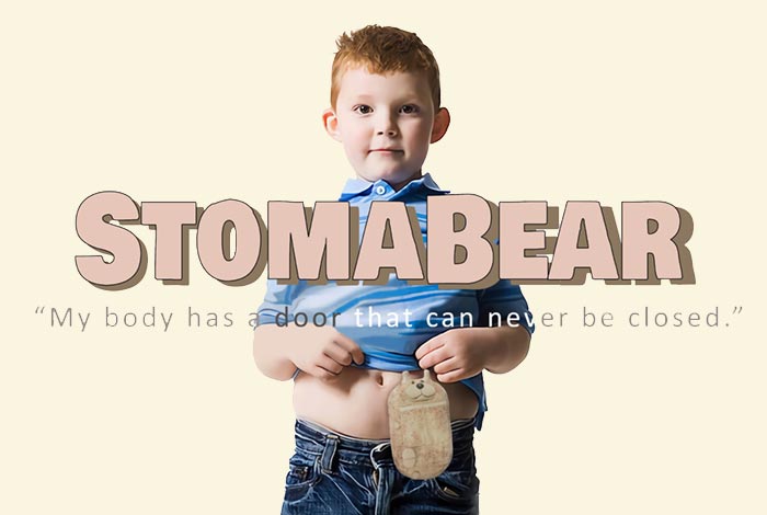 StomaBear-An intelligent stomabag - VPDA